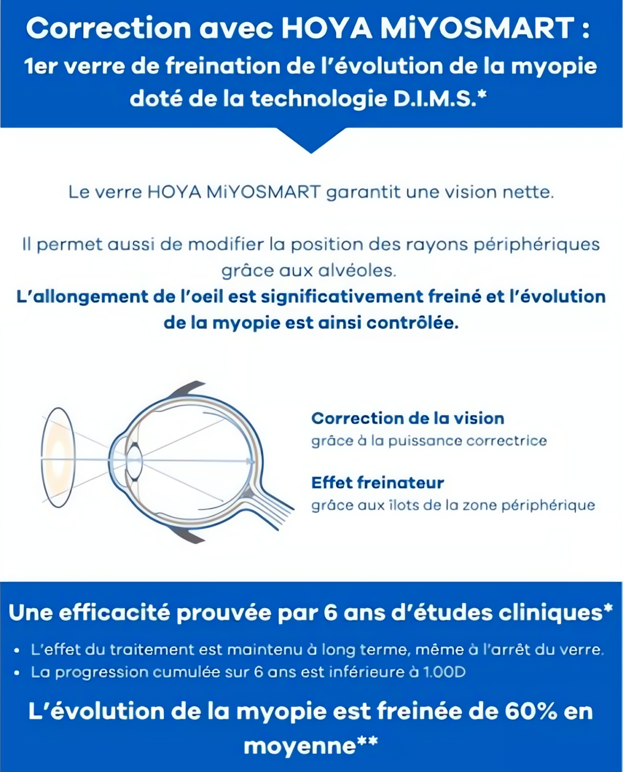 MiYOSMART : Verre innovant pour freiner la myopie